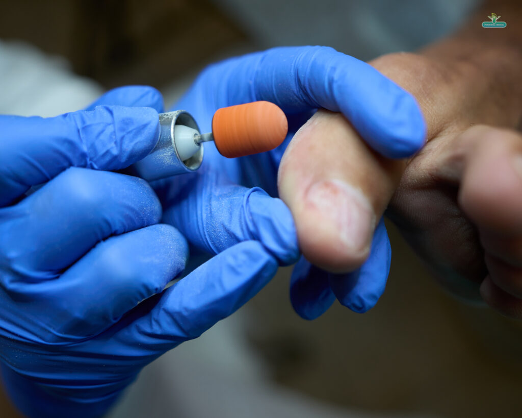 Podologijos Centras - Podologas Vilniuje (Pėdų Gydymas) - Podoklinika